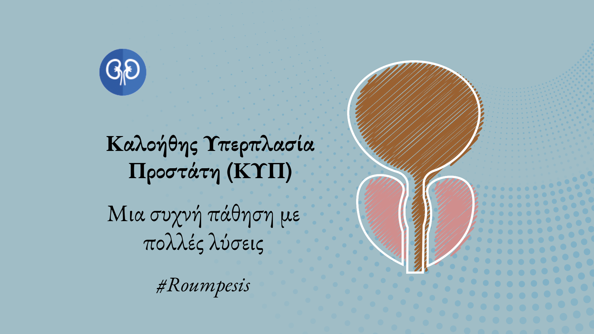 Καλοήθης Υπερπλασία Προστάτη (ΚΥΠ) - Μια συχνή πάθηση με πολλές λύσεις ...